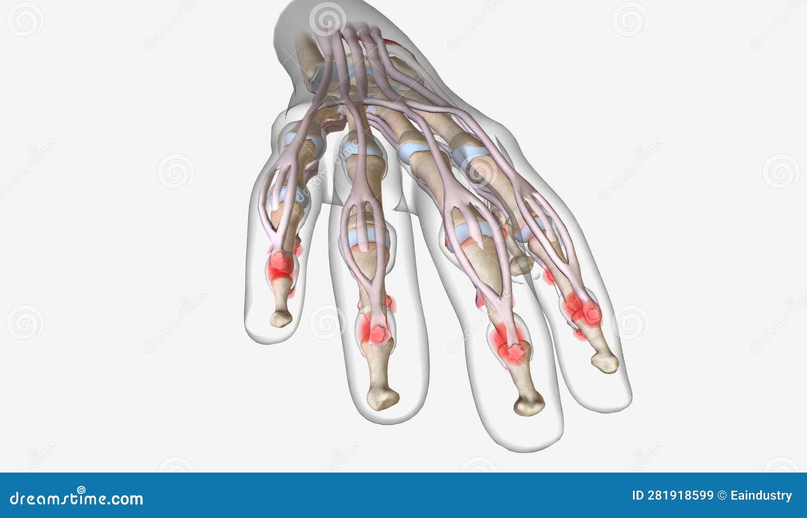 Hand Joints Of A Man. Concept Of Rheumatic Arthritis, Rheumatism, Gout ...