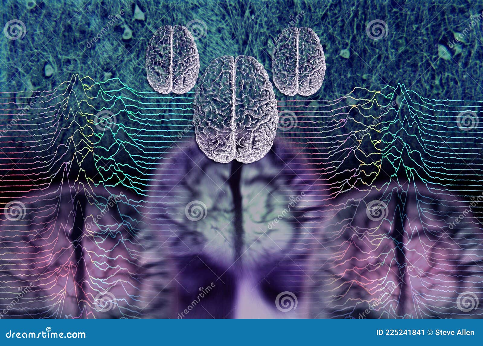 Psychiatry - Brain Imaging and Brain Mapping Stock Illustration ...