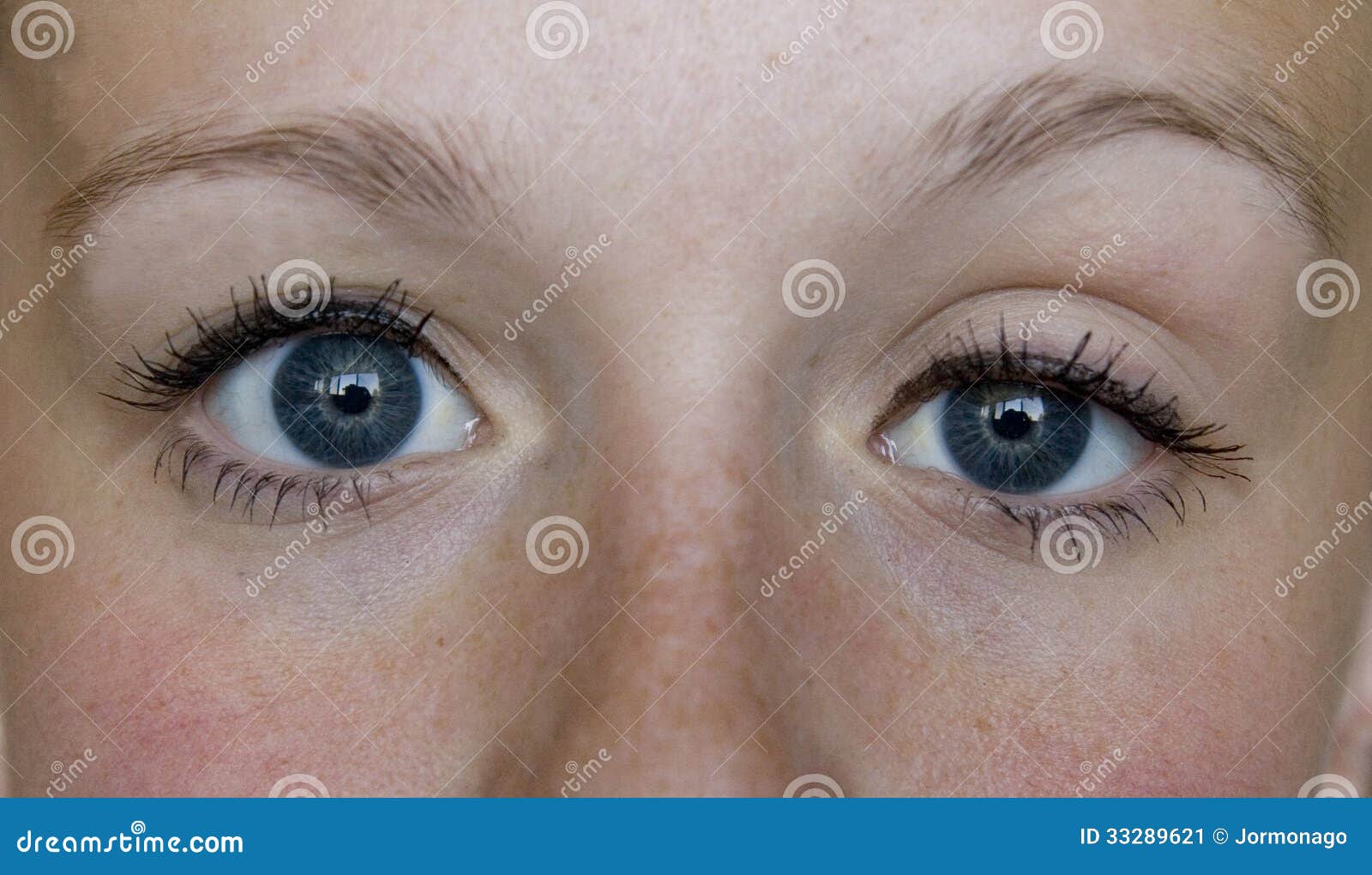 Ptosis/Neerhangend Ooglid stock afbeelding. Image of lichaam - 33289621