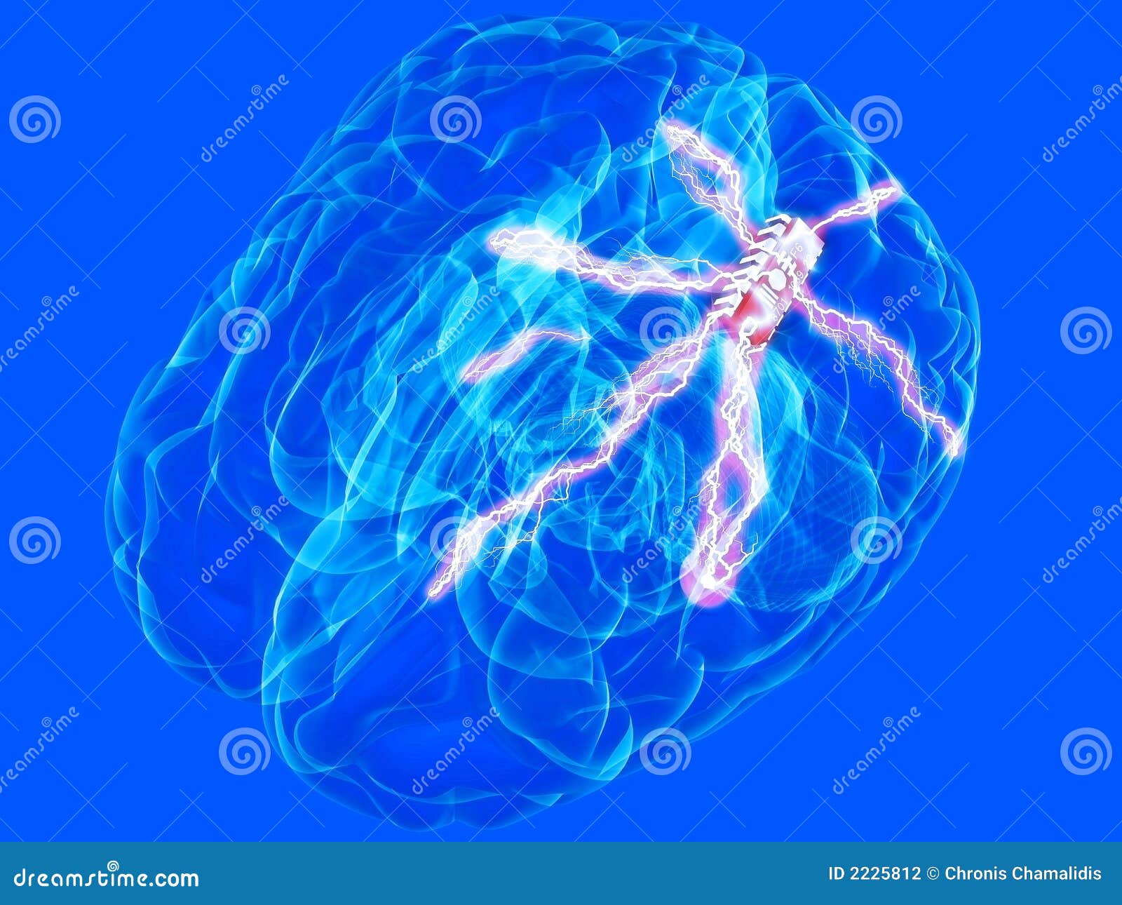 Puce de cerveau illustration stock. Illustration du opération - 2225812