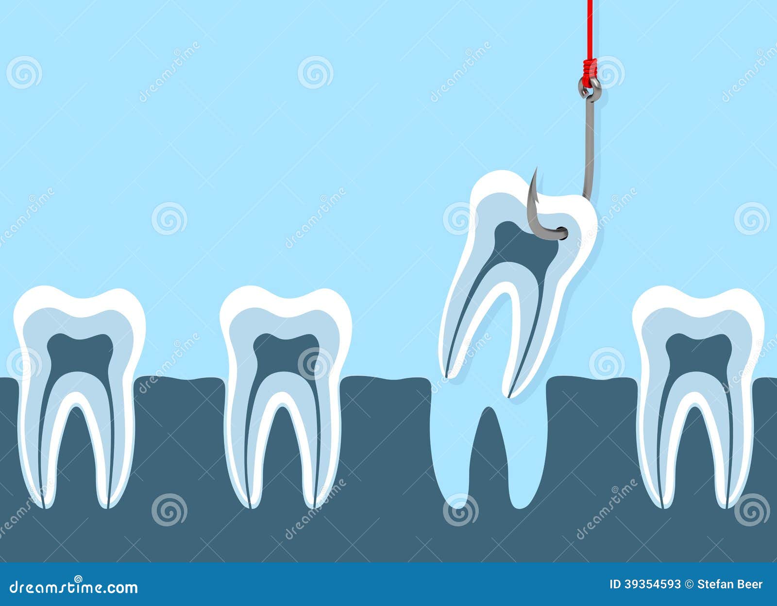 Pull a tooth stock illustration. Illustration of dental - 39354593