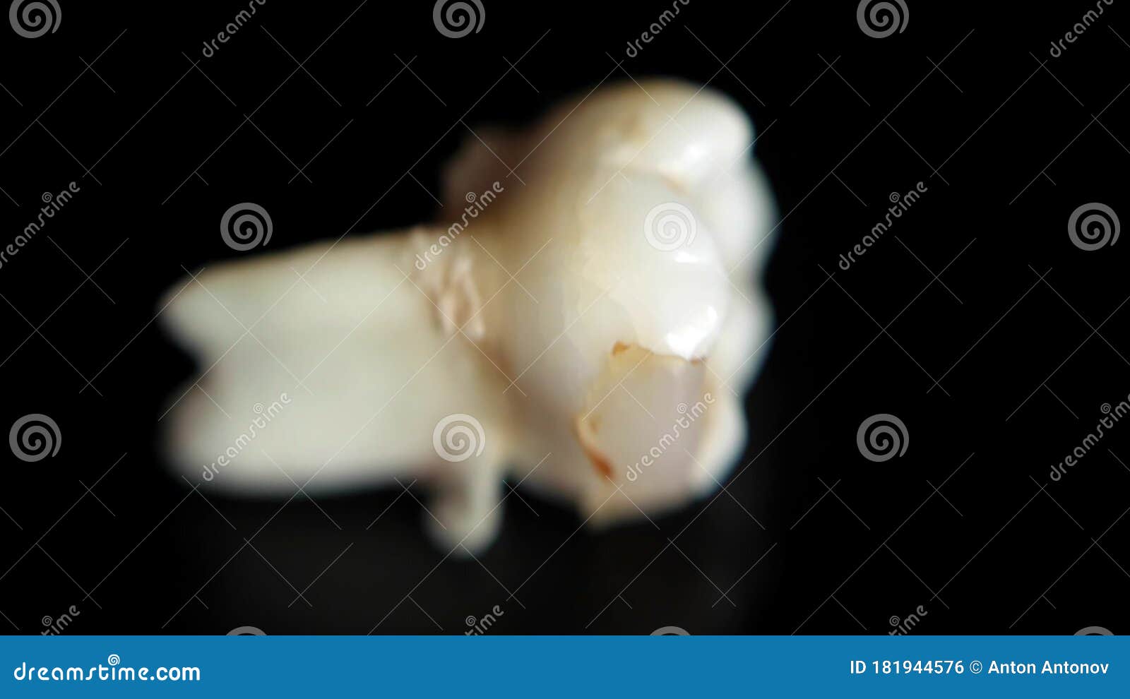 Pulled Out Baby Tooth on a Black Background. Extracted Tooth Isolated ...