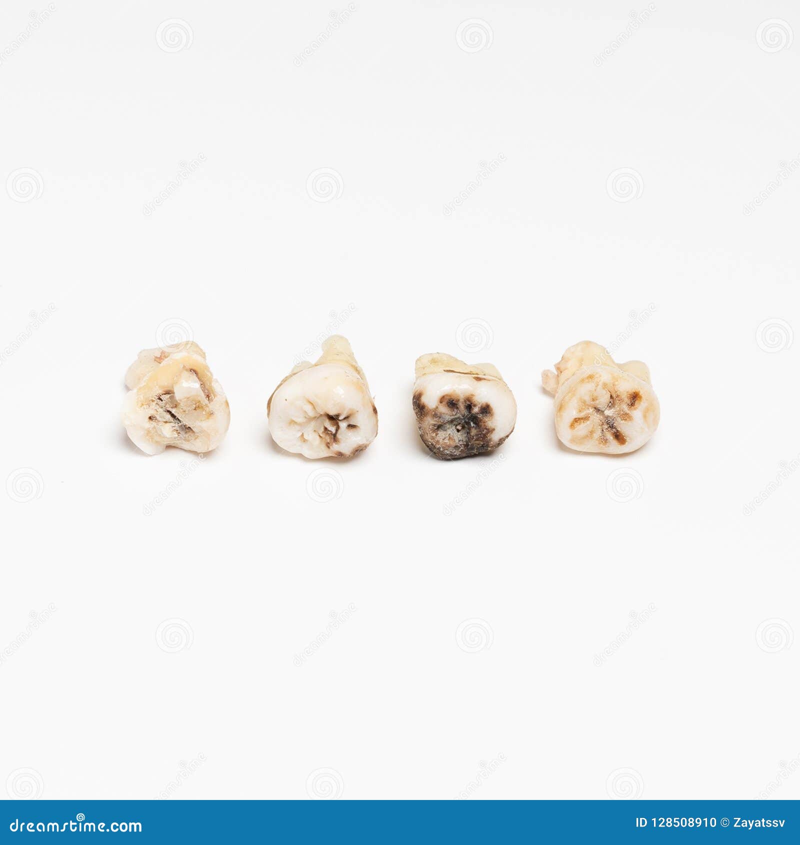 Pulled Out Bad Molars Human Teeth Close Up on White Background Stock ...