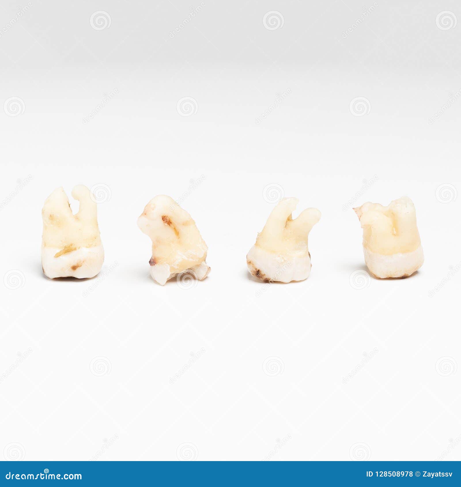 Pulled Out Bad Molars Human Teeth Close Up on White Background Stock ...