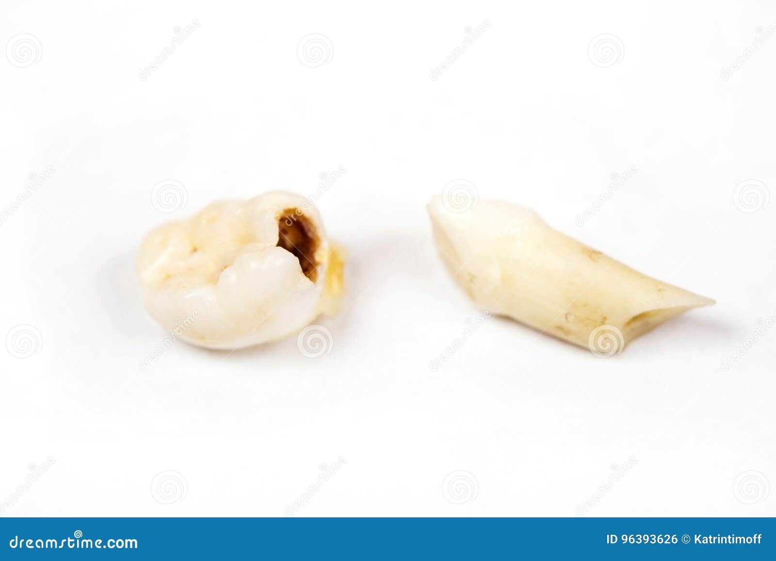 Pulled-out milk tooth stock photo. Image of hygiene, milk - 96393626