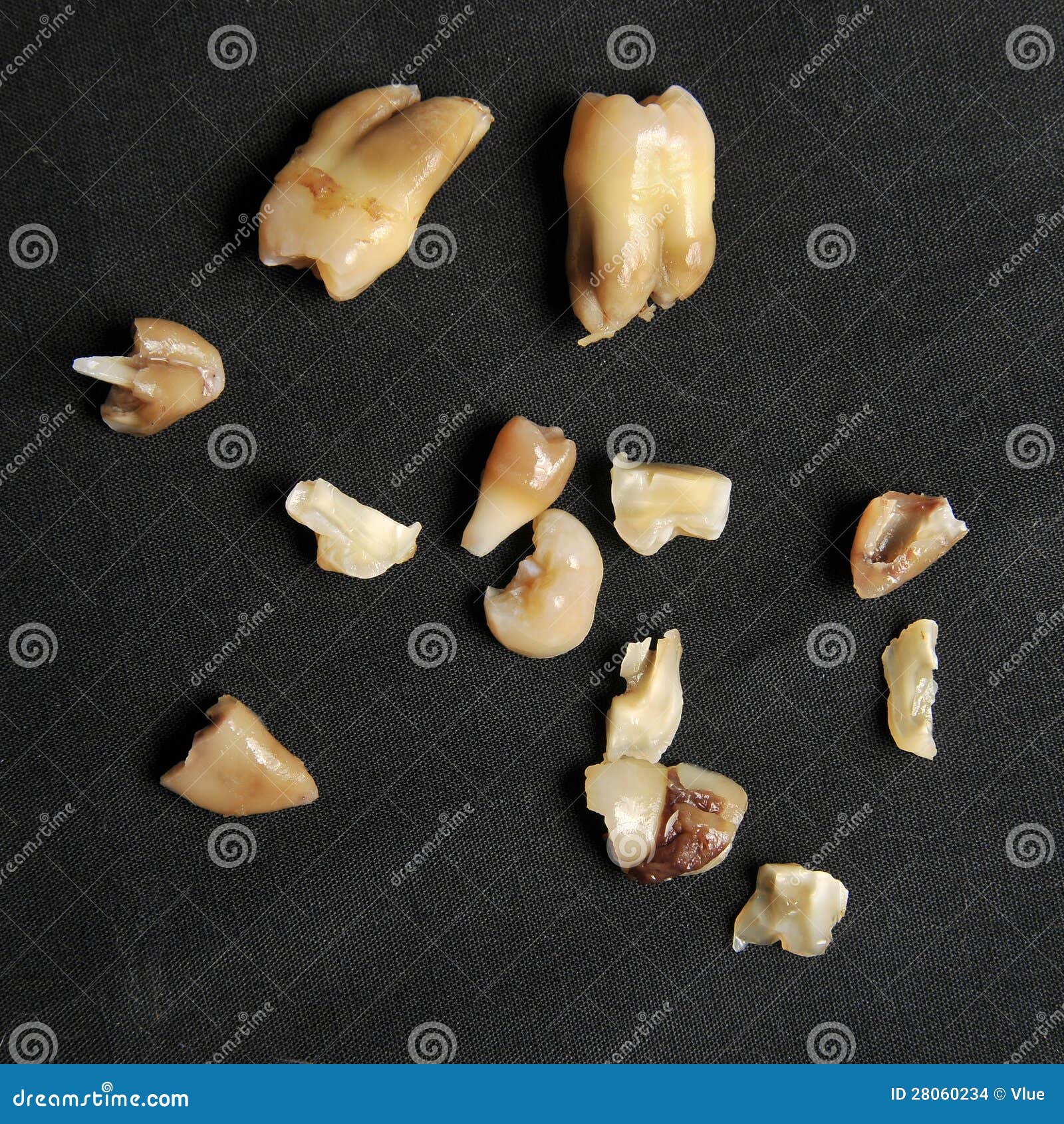 Pulled teeth on black stock photo. Image of carious, human - 28060234