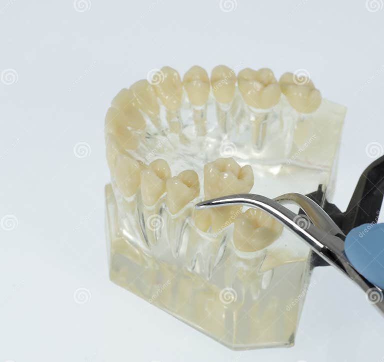 Pulling a tooth stock image. Image of pulling, teeth - 35138227