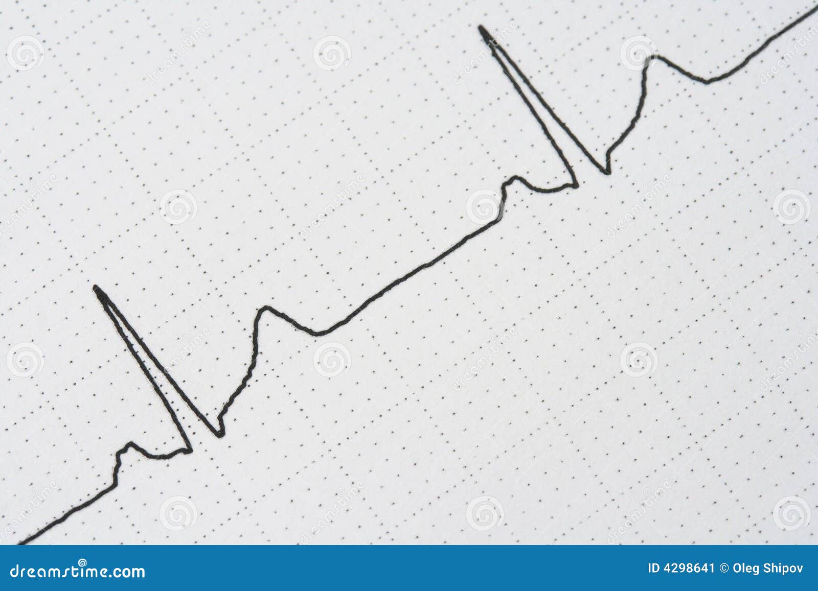 Pulse trace stock image. Image of electrocardiogram, electrical - 4298641