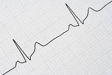 Pulse trace stock image. Image of electrocardiogram, electrical - 4298641