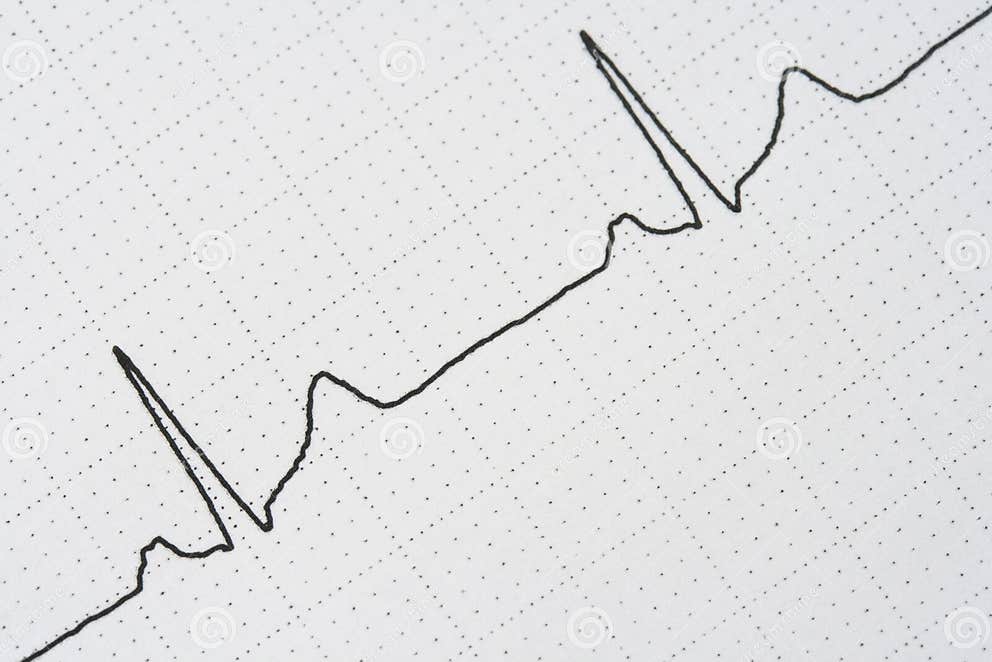 Pulse trace stock image. Image of electrocardiogram, electrical - 4298641