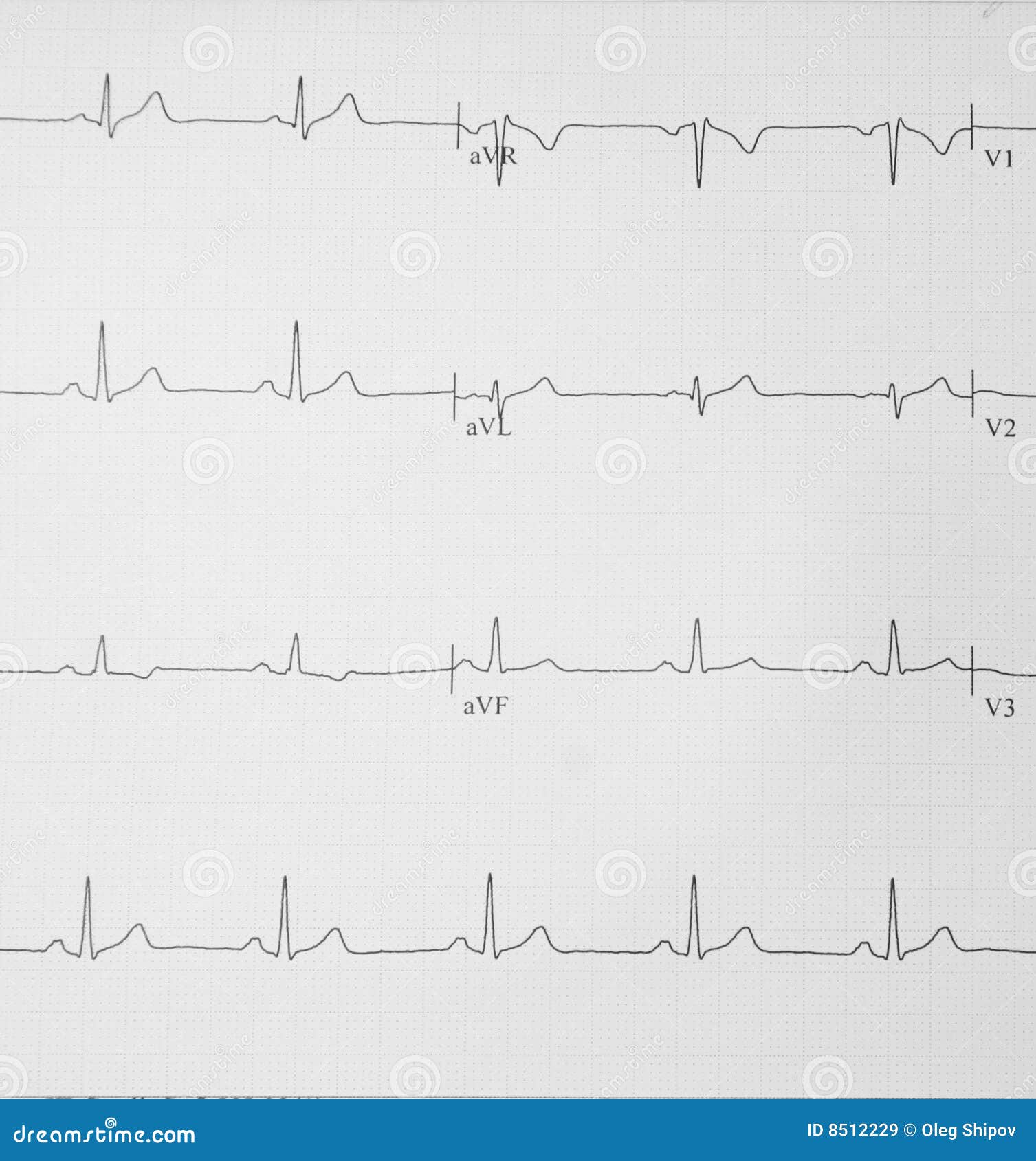 Pulse trace stock image. Image of electrocardiography - 8512229