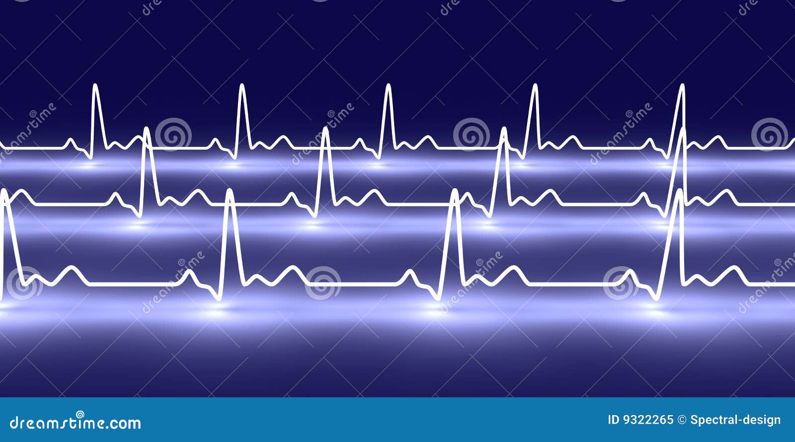Pulse trace stock illustration. Illustration of monitor - 9322265