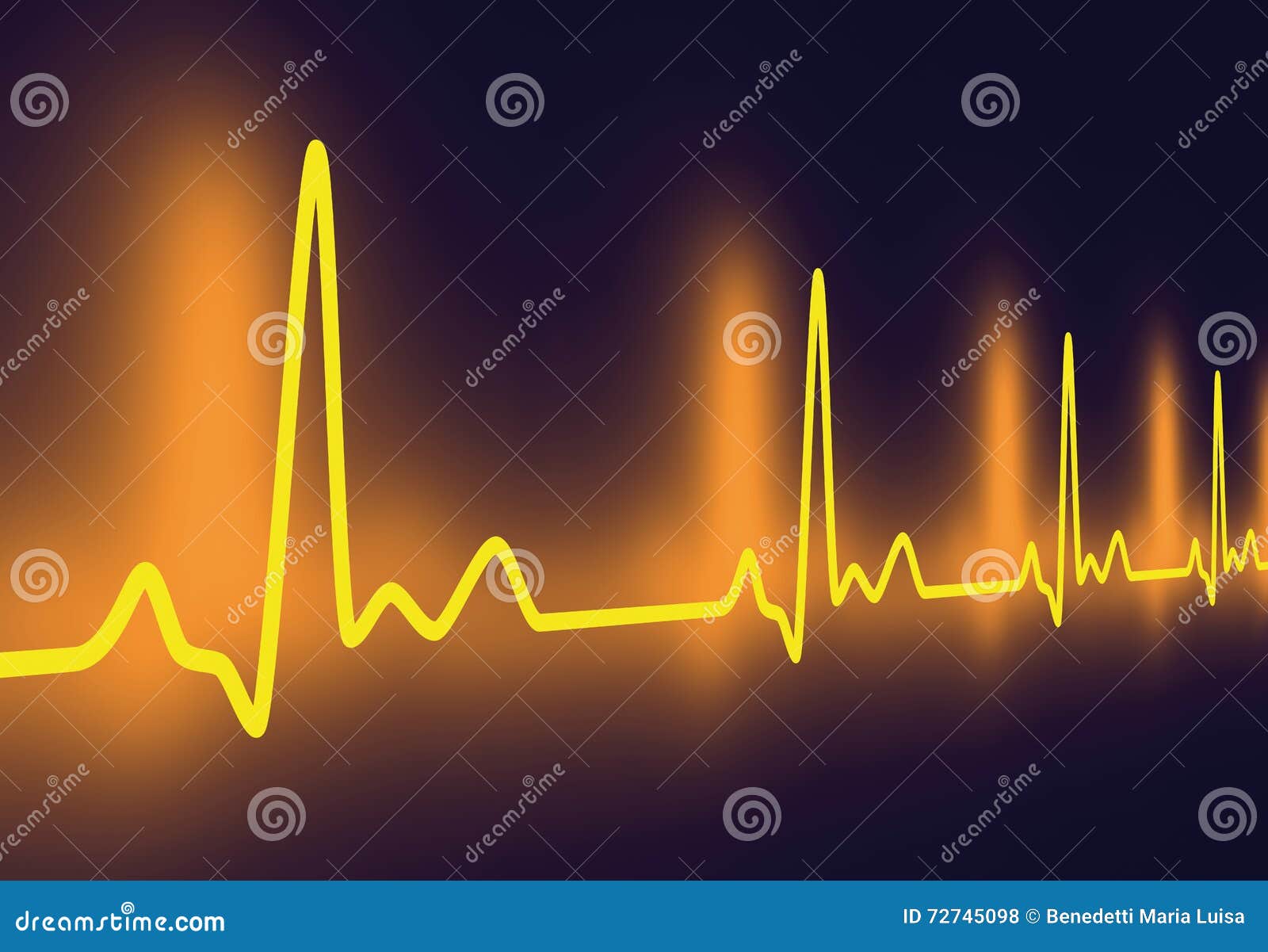 Pulse trace stock illustration. Illustration of heartbeat - 72745098