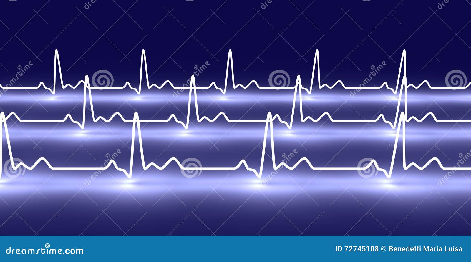 Pulse trace stock illustration. Illustration of heartbeat - 72745108