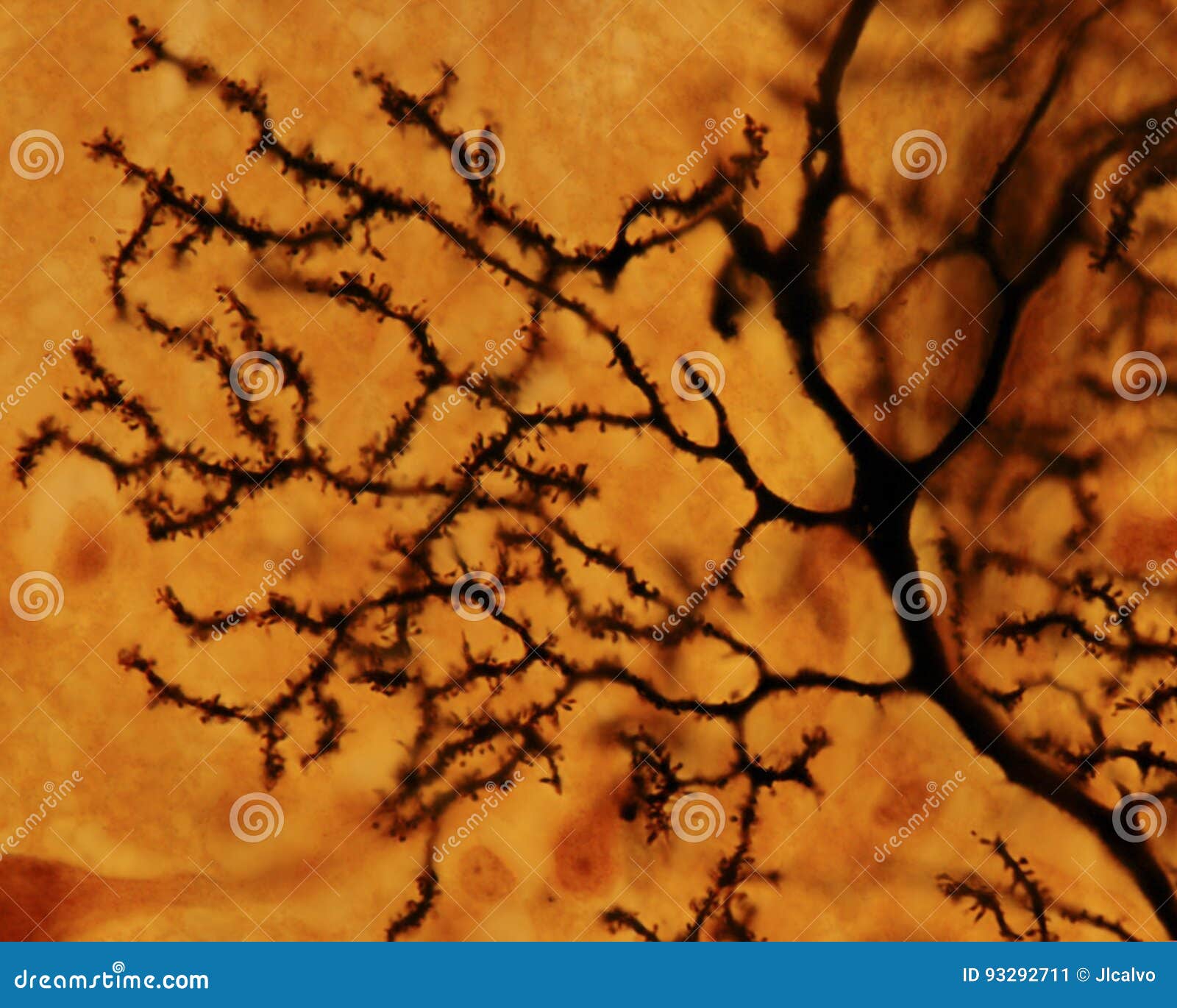 Purkinje Neuron. Dendritic Tree Stock Image - Image of tissue ...
