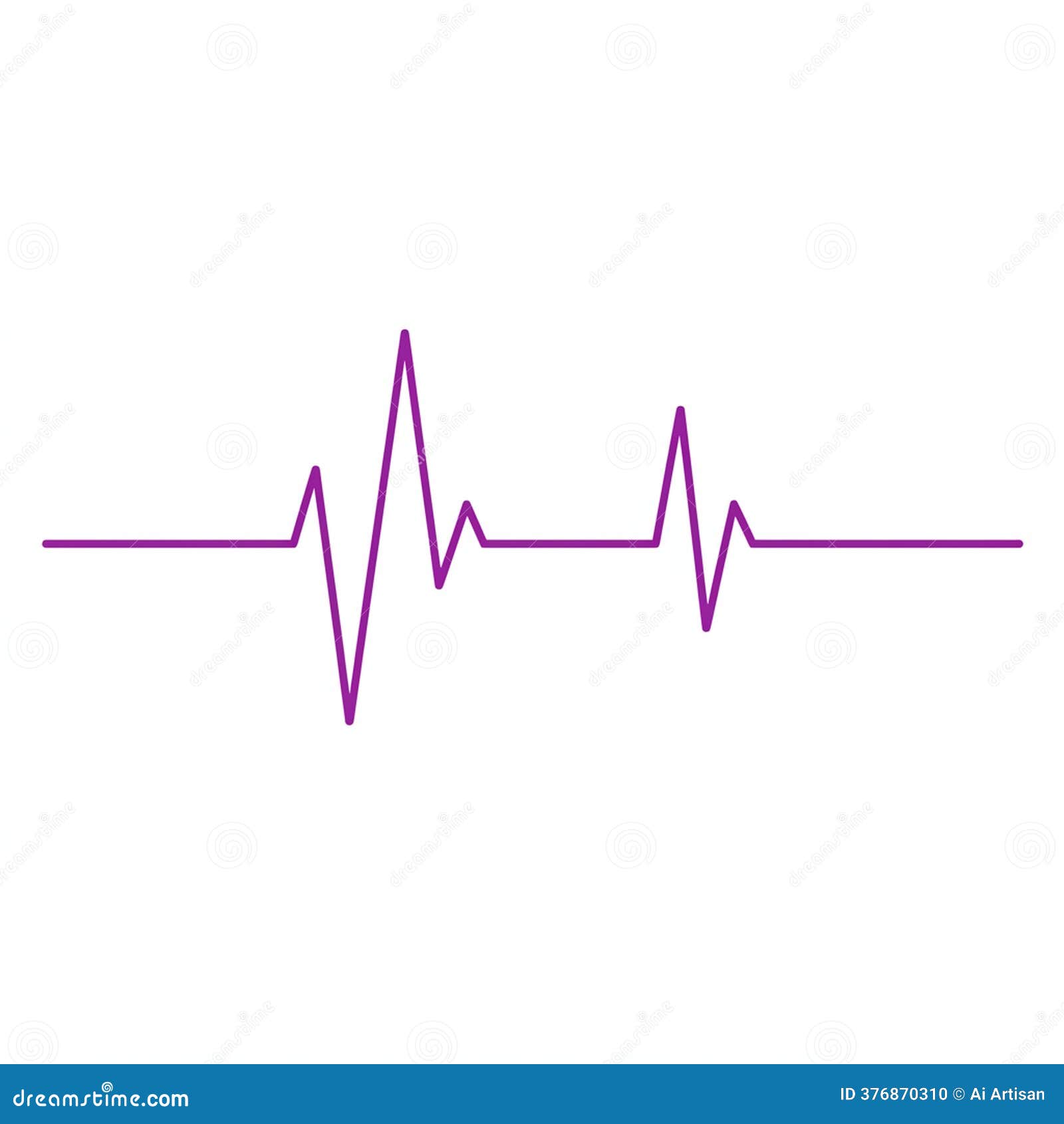 Electrocardiogram (ECG) Trace On Pink Graph Paper Displays A Sequence ...