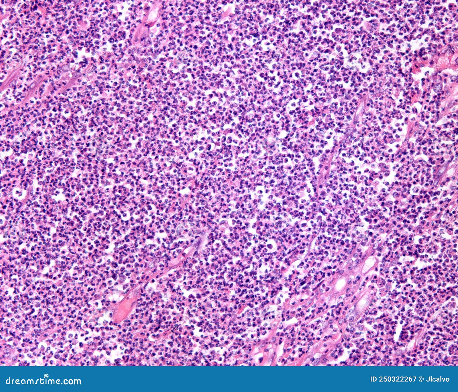 Pus stock image. Image of medicine, blood, micrograph - 250322267