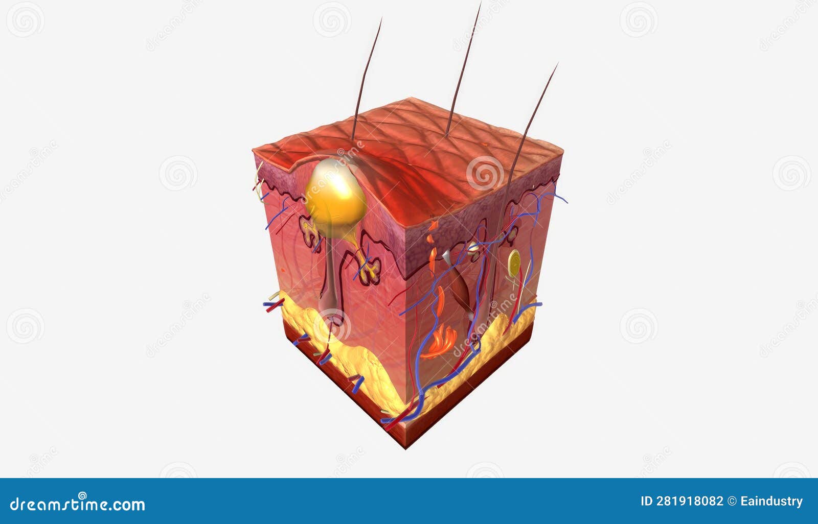 Pustules are a Type of Acne Characterized by Large, Inflamed Bumps with ...