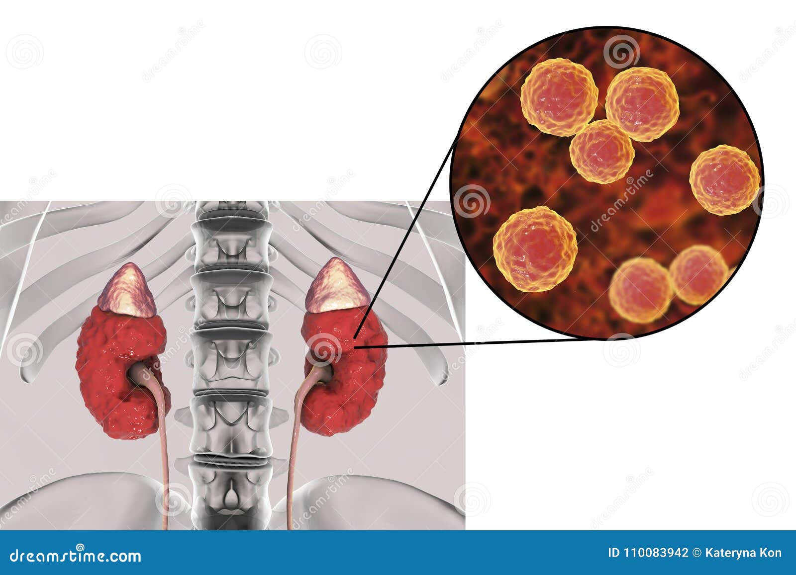 Bacteria Enterococcus, Illustration Royalty-Free Cartoon ...