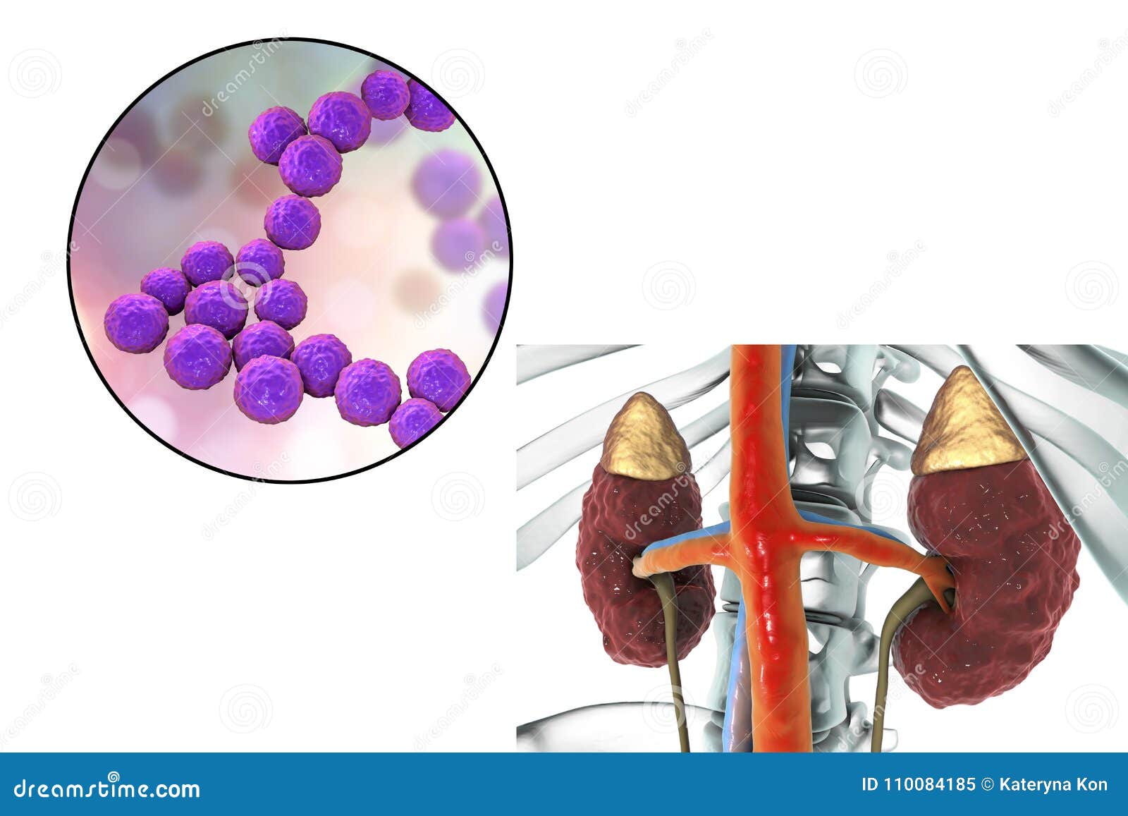 Bacteria Enterococcus, Illustration Royalty-Free Cartoon ...