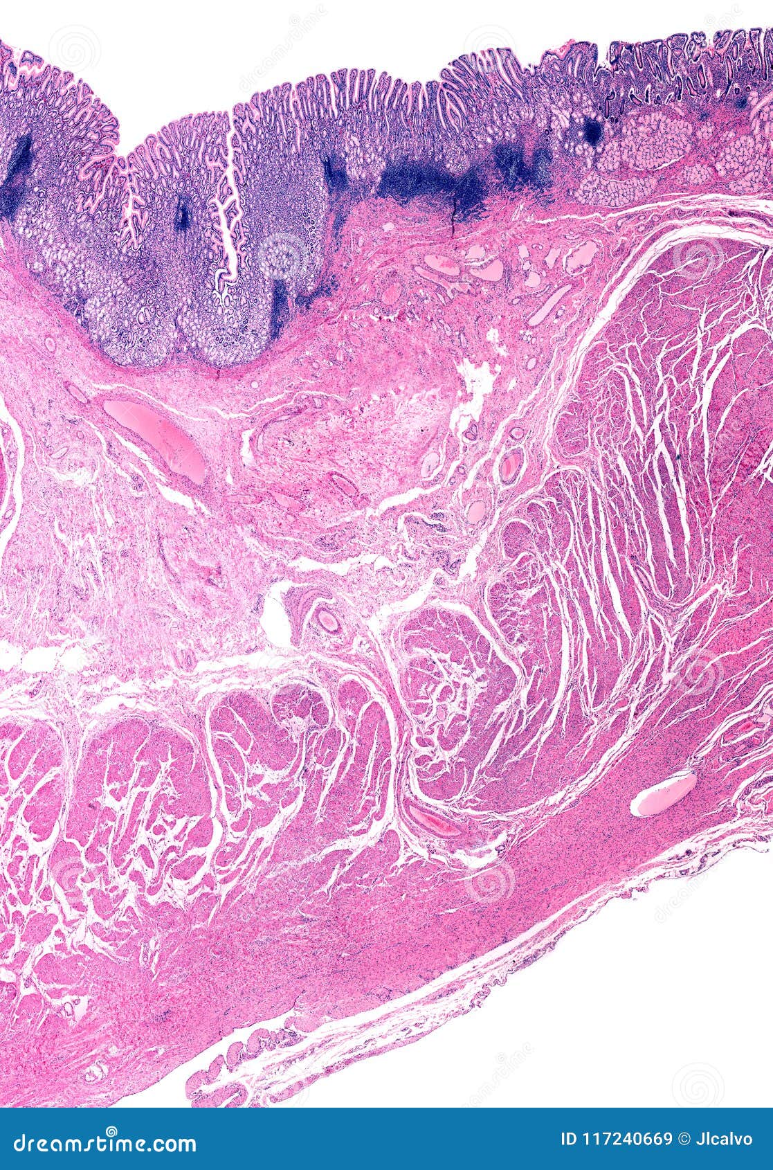 Pylore image stock. Image du musculaire, micrographe - 117240669