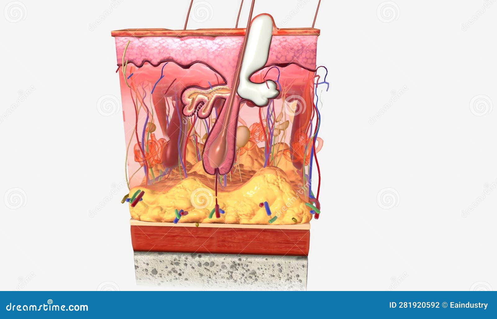 Pyoderma Gangrenosum Stage II 3d Stock Illustration - Illustration of ...
