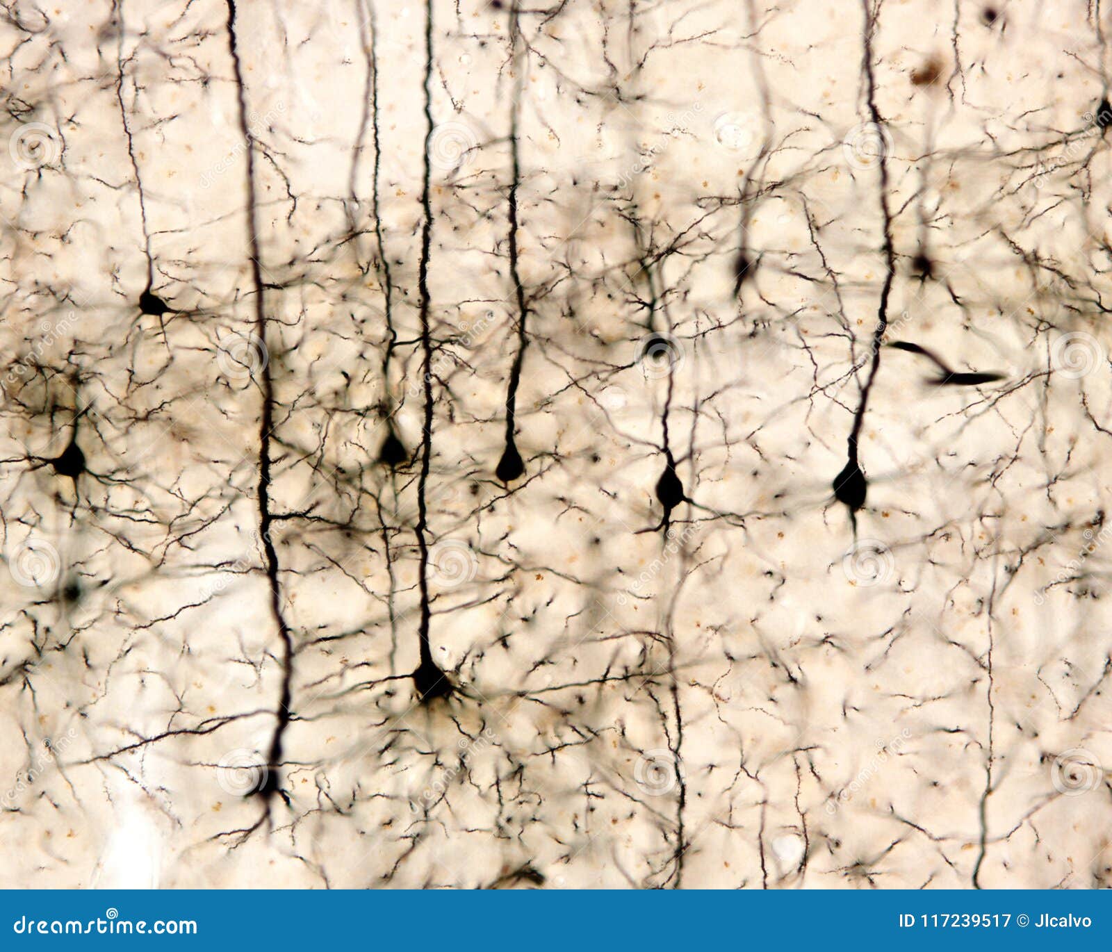 Pyramidal Neurons