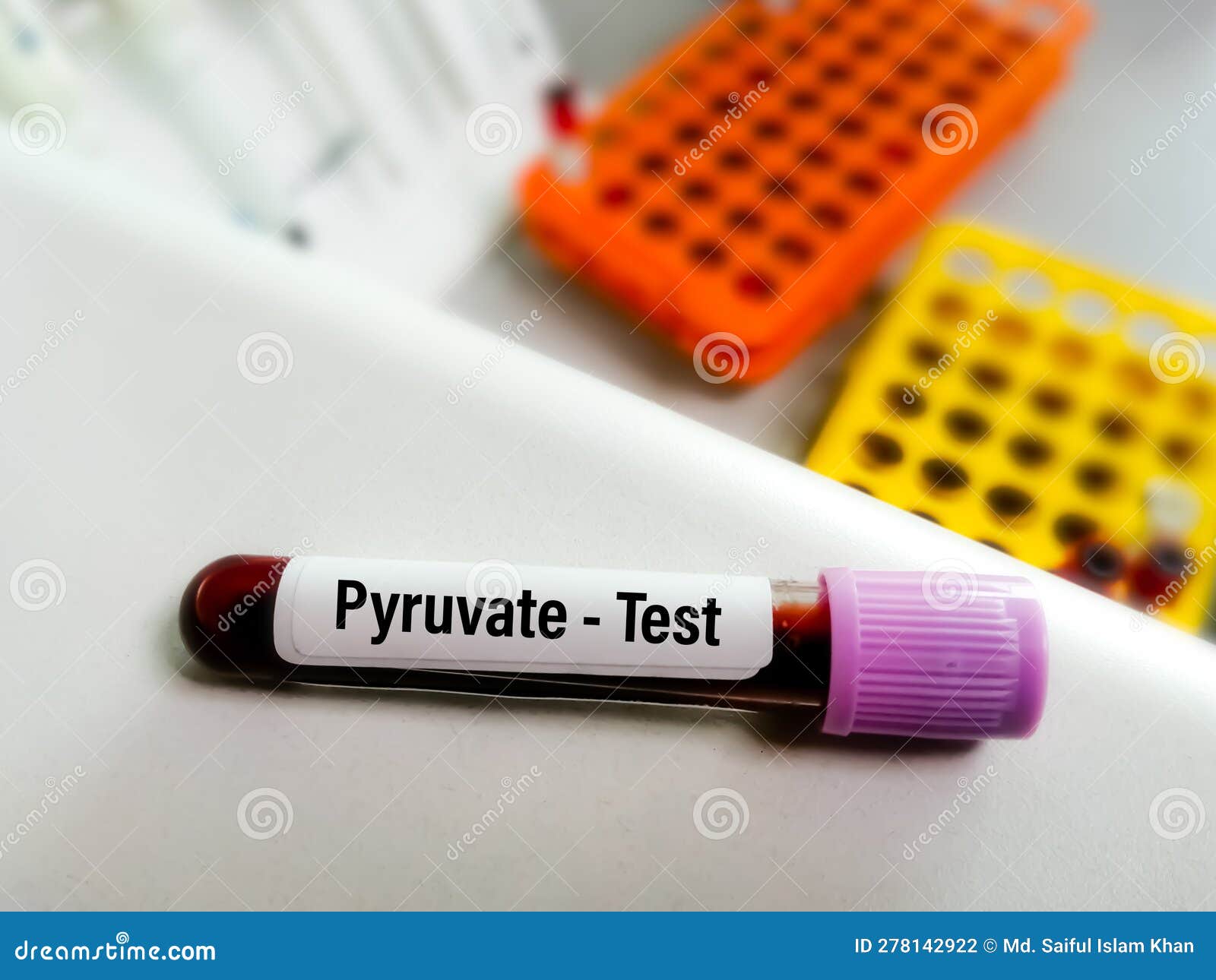 Pyruvate test stock photo. Image of closeup, test, hospital - 278142922