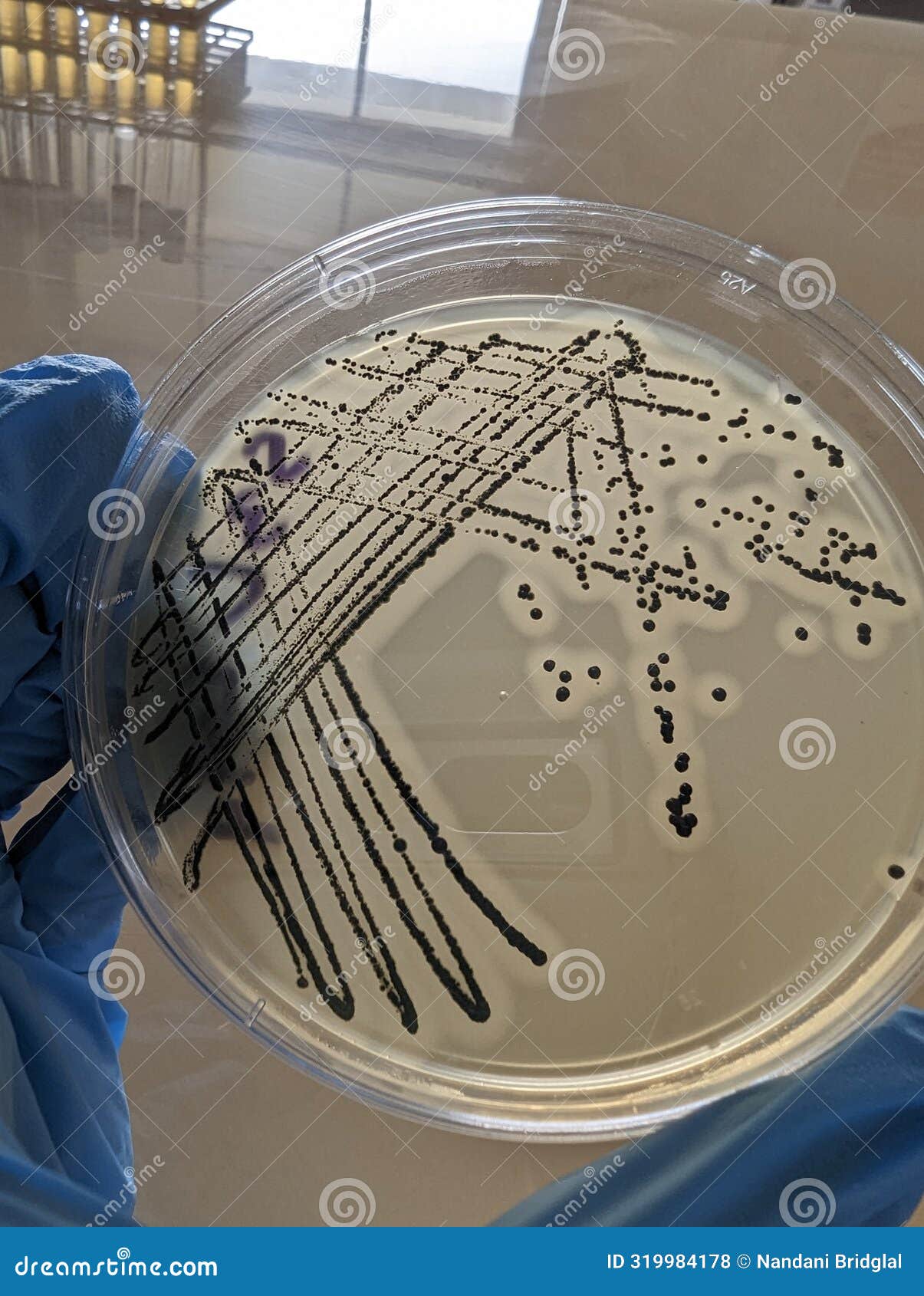 Quadrant Streak of Staphylococcus Aureus on Baird Parker Agar Plate ...
