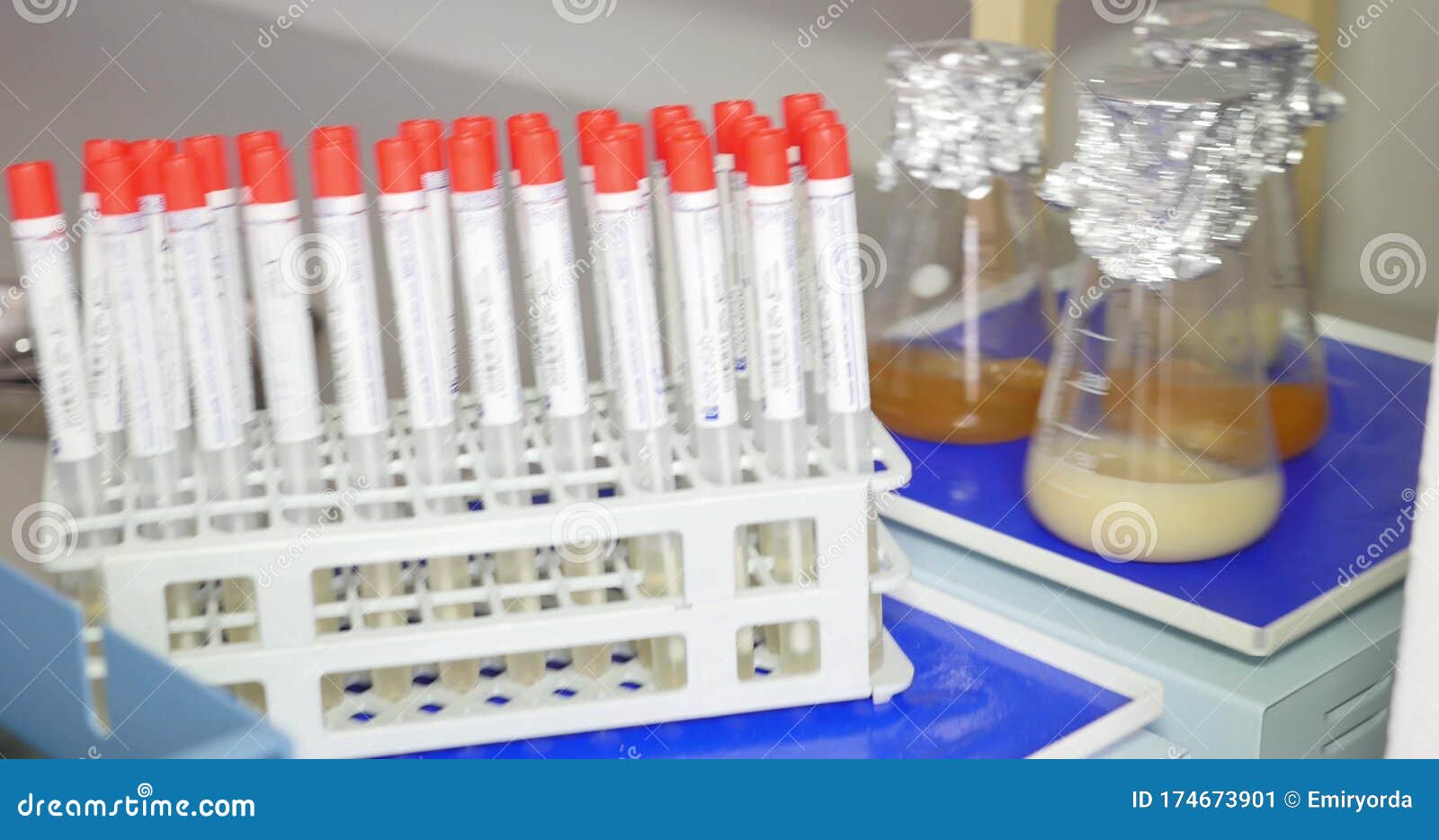 Quality Check of Food and Beverages in a Laboratory, the Samples are ...