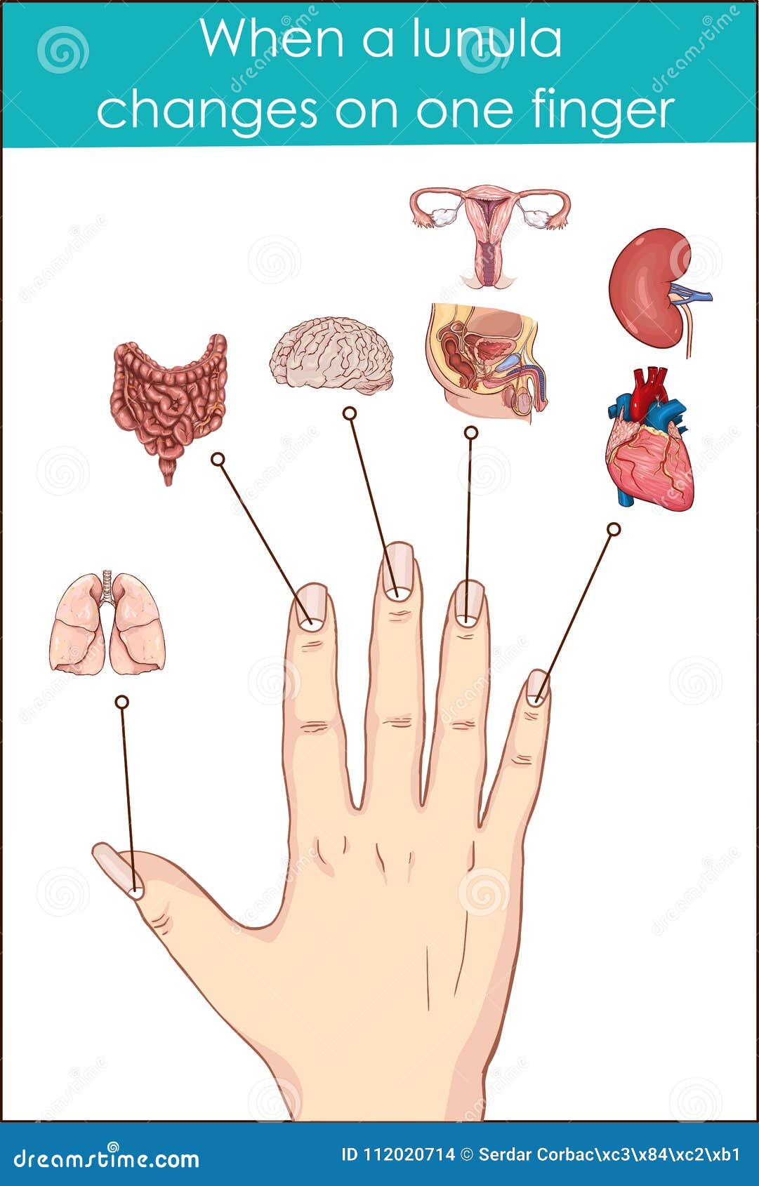 Quando Un Lunula Cambia Su Un Dito Illustrazione Vettoriale ...