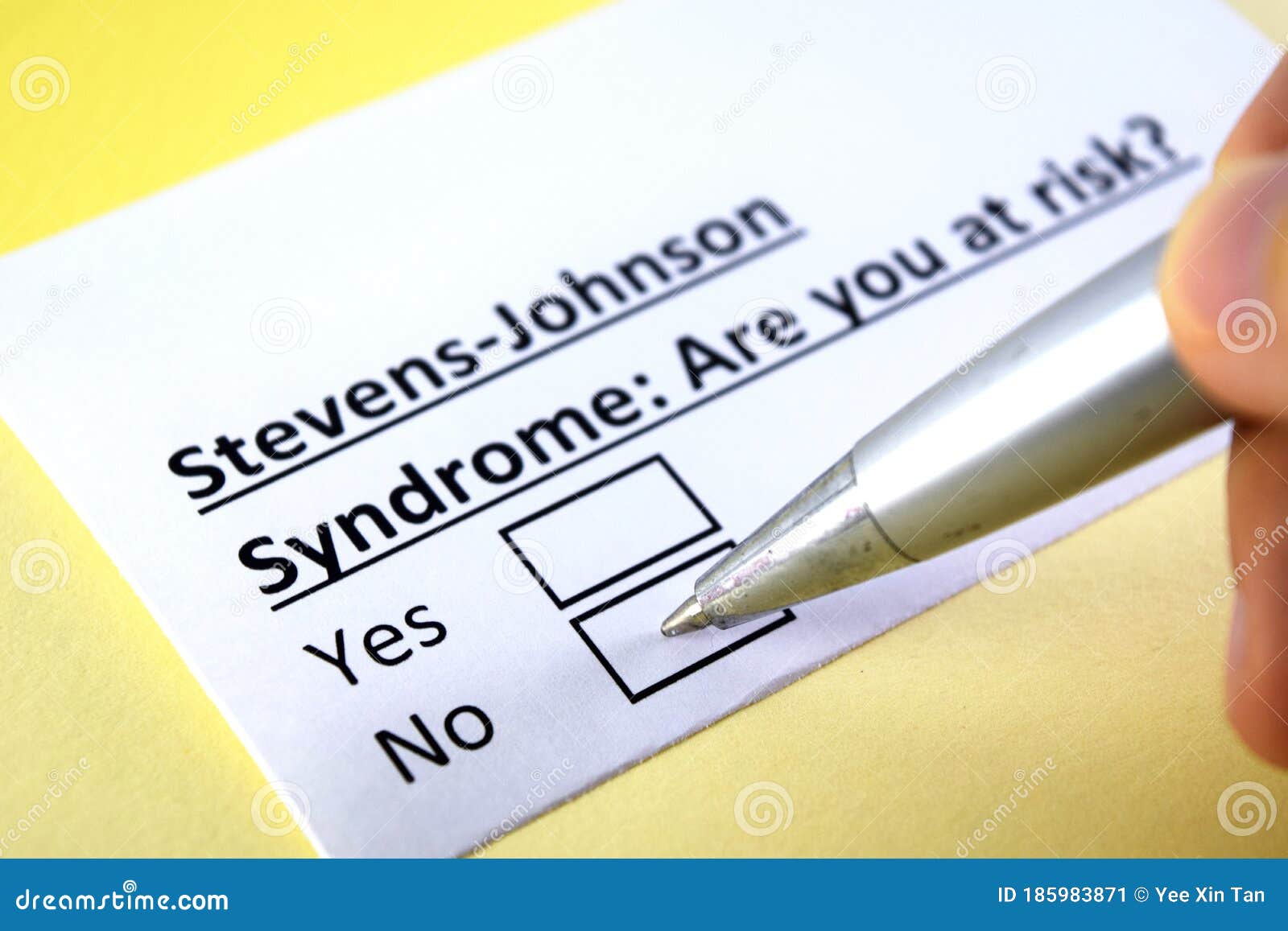 Hafif Steven Johnson Sendromu