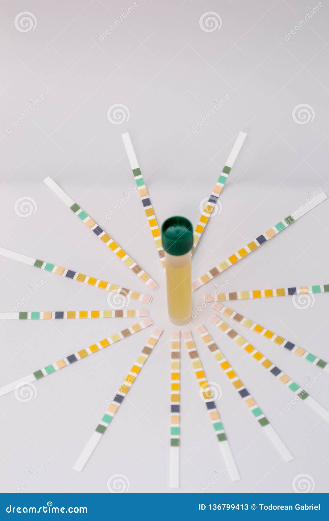 Urine Sample and Urine Strips Stock Image - Image of disease, diabetes ...