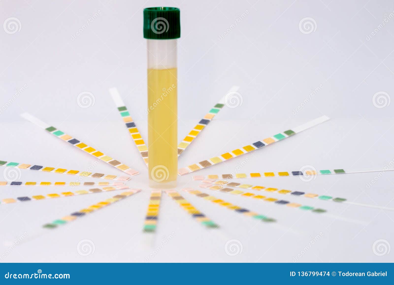 Urine Sample and Urine Strips Stock Photo - Image of bottle, infection ...
