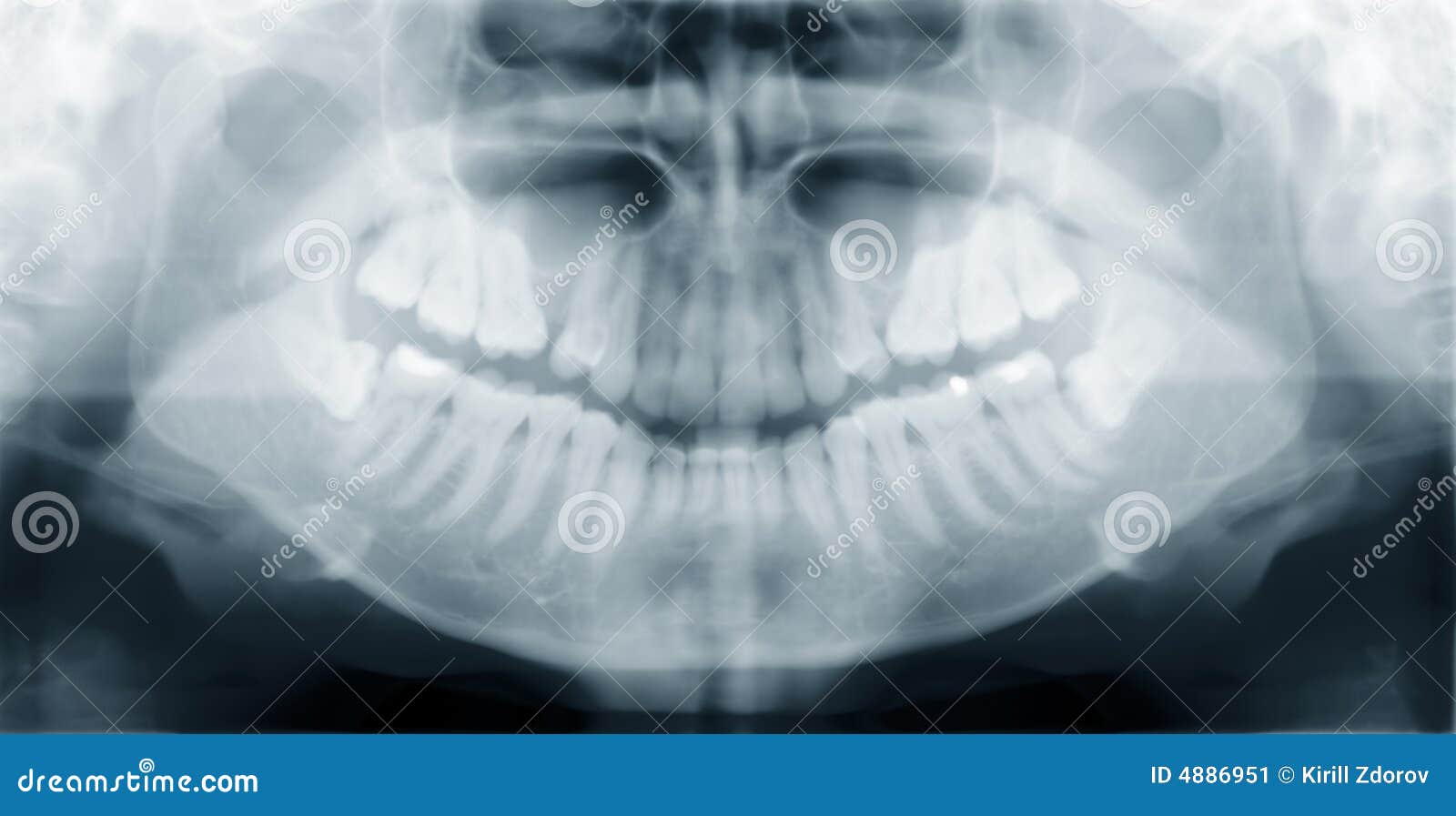 Quijada imagen de archivo. Imagen de boca, ortodoncia - 4886951