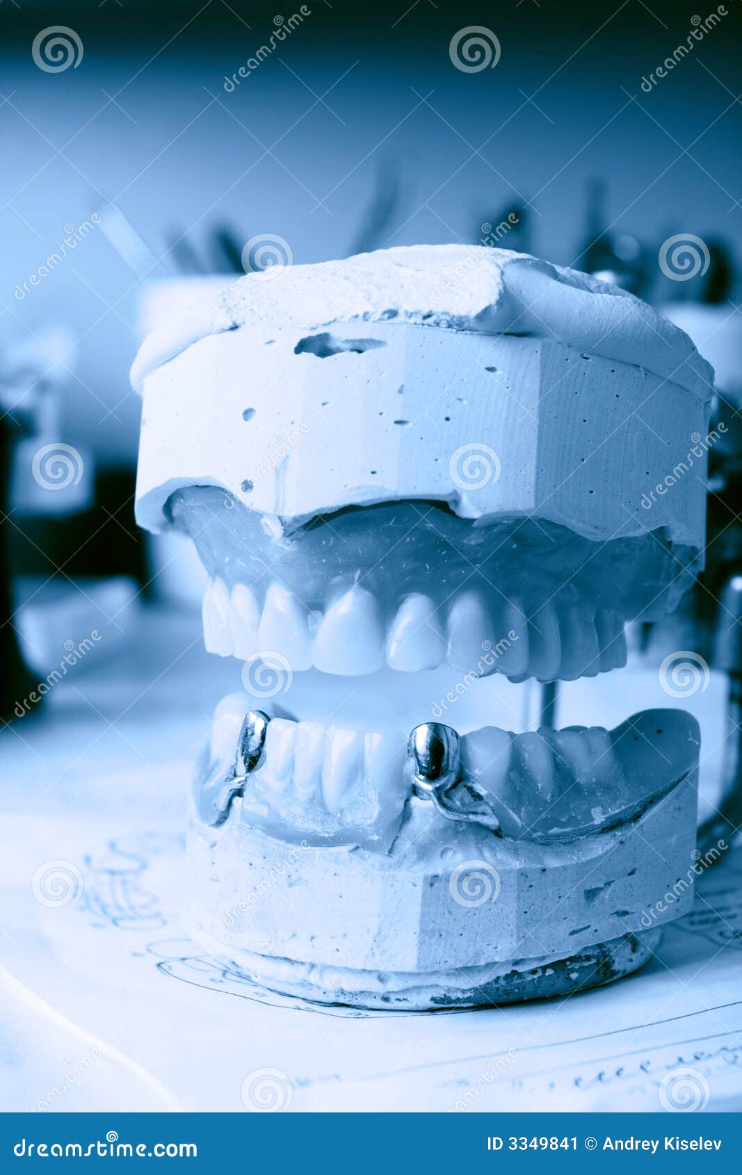 Quijada de la quijada imagen de archivo. Imagen de molde - 3349841