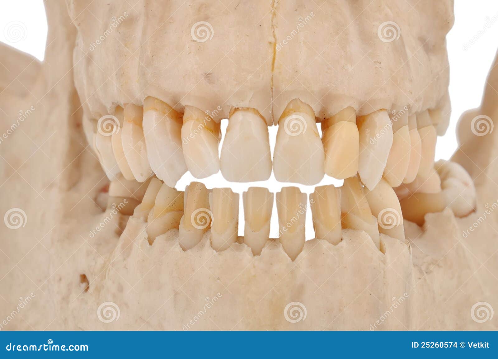 Quijada humana foto de archivo. Imagen de dientes, cierre - 25260574