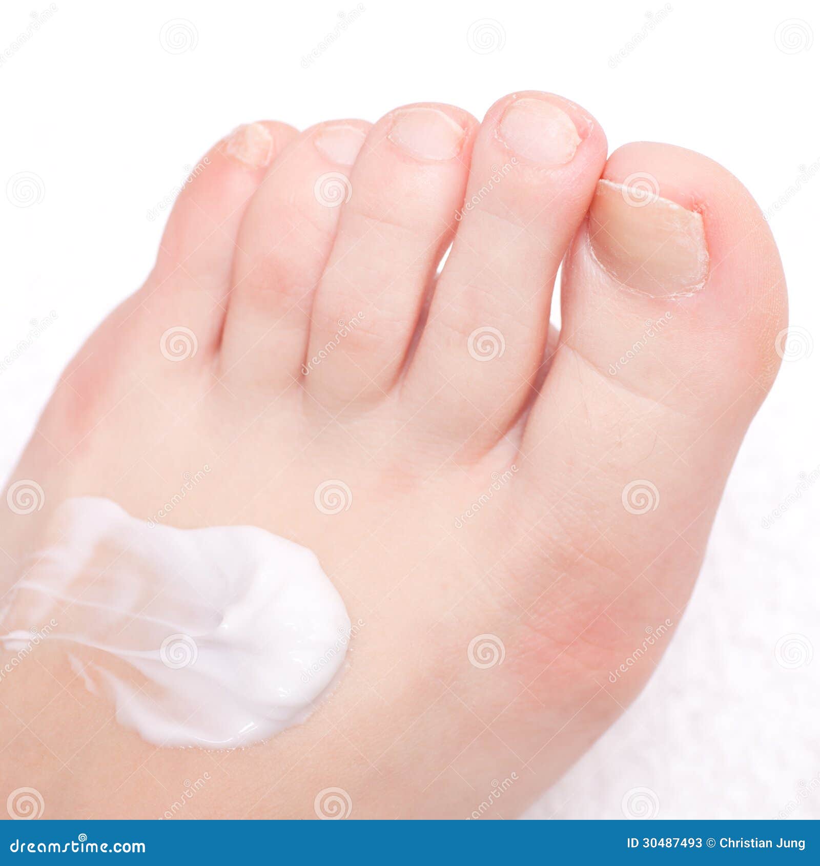 Quiropodia imagen de archivo. Imagen de fichero, cuidado - 30487493