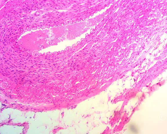 Rabbit Artery stock image. Image of stain, cell, blood - 62322045