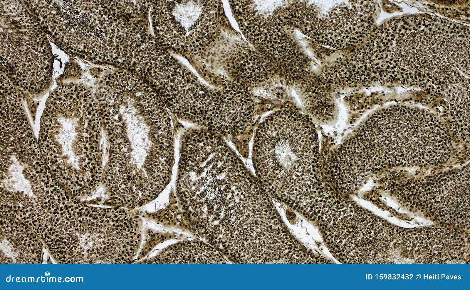 Rabbit Testicle, Cross-section Stock Photo - Image of cellular ...