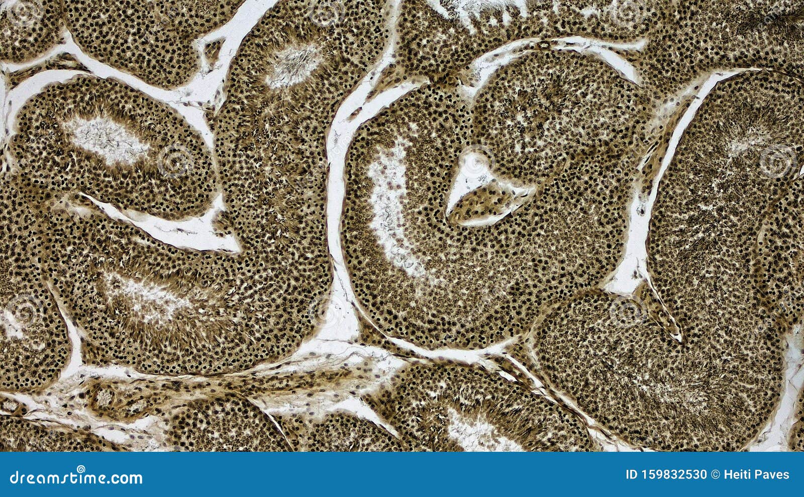 Rabbit Testicle, Cross-section Stock Photo - Image of gonad, germ ...