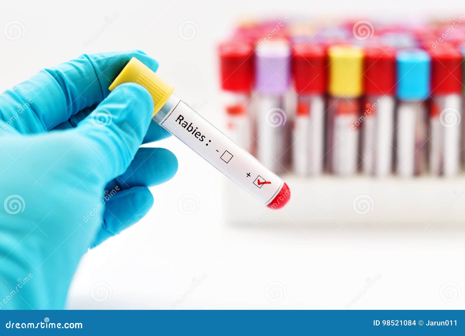 Rabies positive stock photo. Image of care, vaccine, laboratory - 98521084