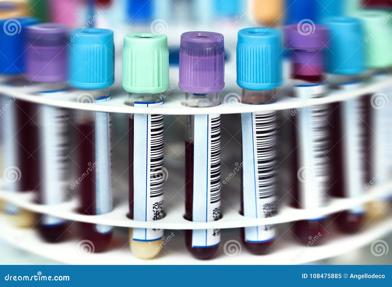 Rack of Blood Tubes with Samples in Centrifuge Stock Image - Image of ...
