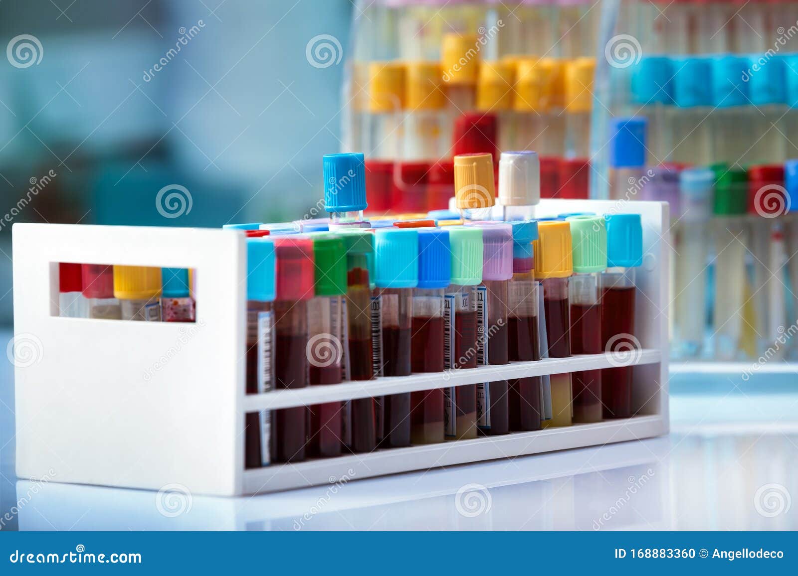 Blood Tubes With Hemodialysis Machine In The Background Stock ...
