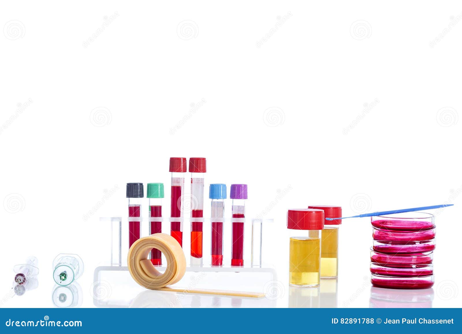 Blood In Urine Analysis As Idea Urogenital System Disease And Prostate ...
