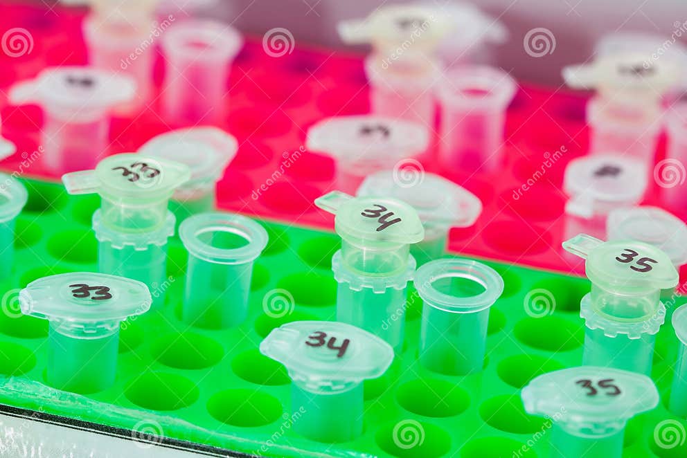 Rack of Test Tubes Being Used for DNA Extraction Using the Spin Column ...