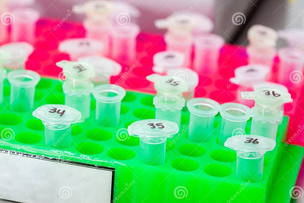 Rack Of Test Tubes Being Used For Dna Extraction Using The Spin Column