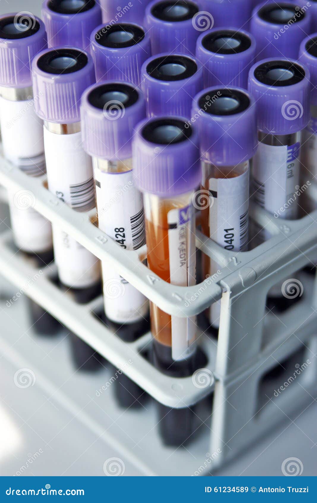 Rack with Test Tubes of Blood Stock Image - Image of equipment ...