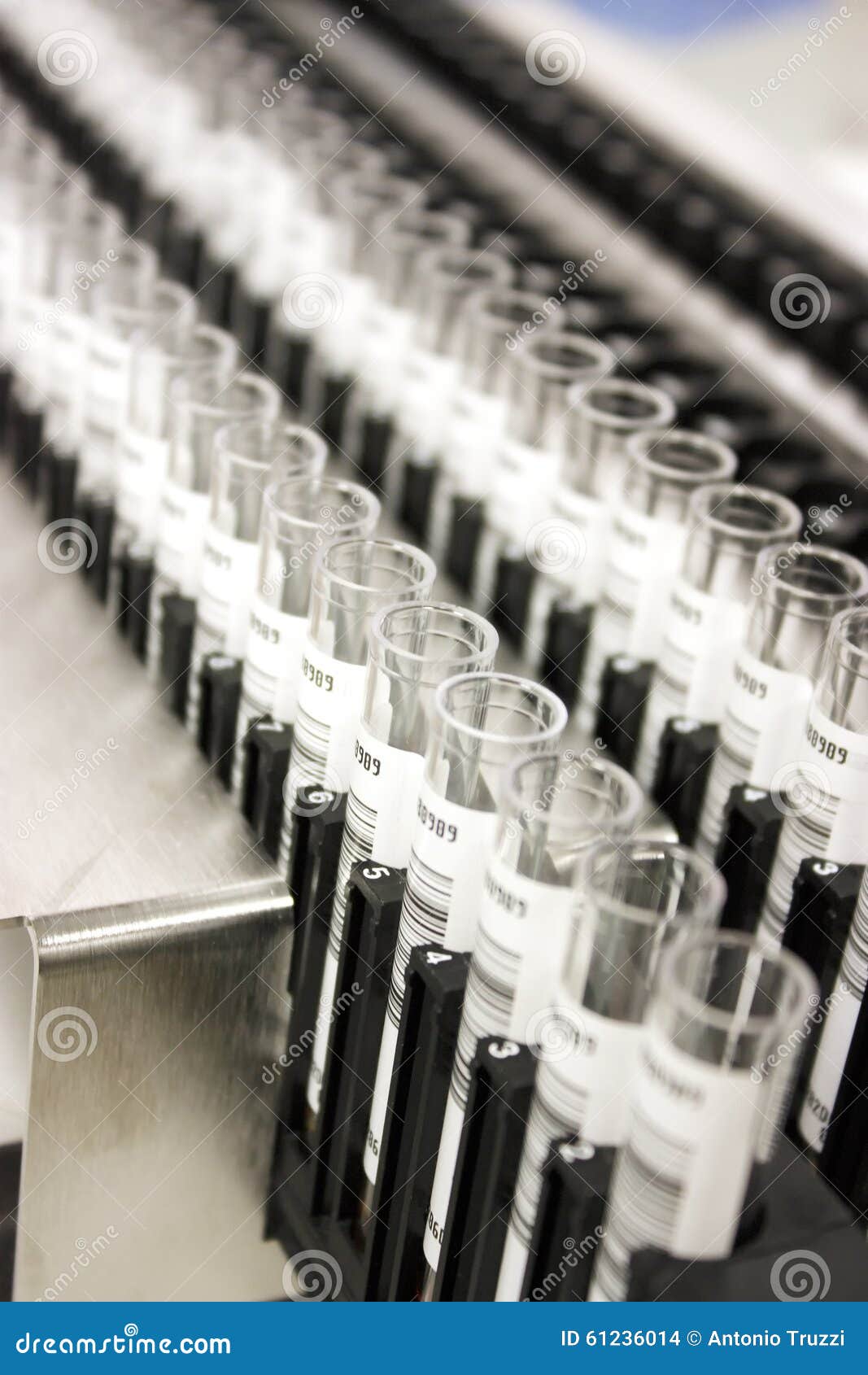 Rack with Test Tubes of Blood Stock Photo - Image of equipment, label ...