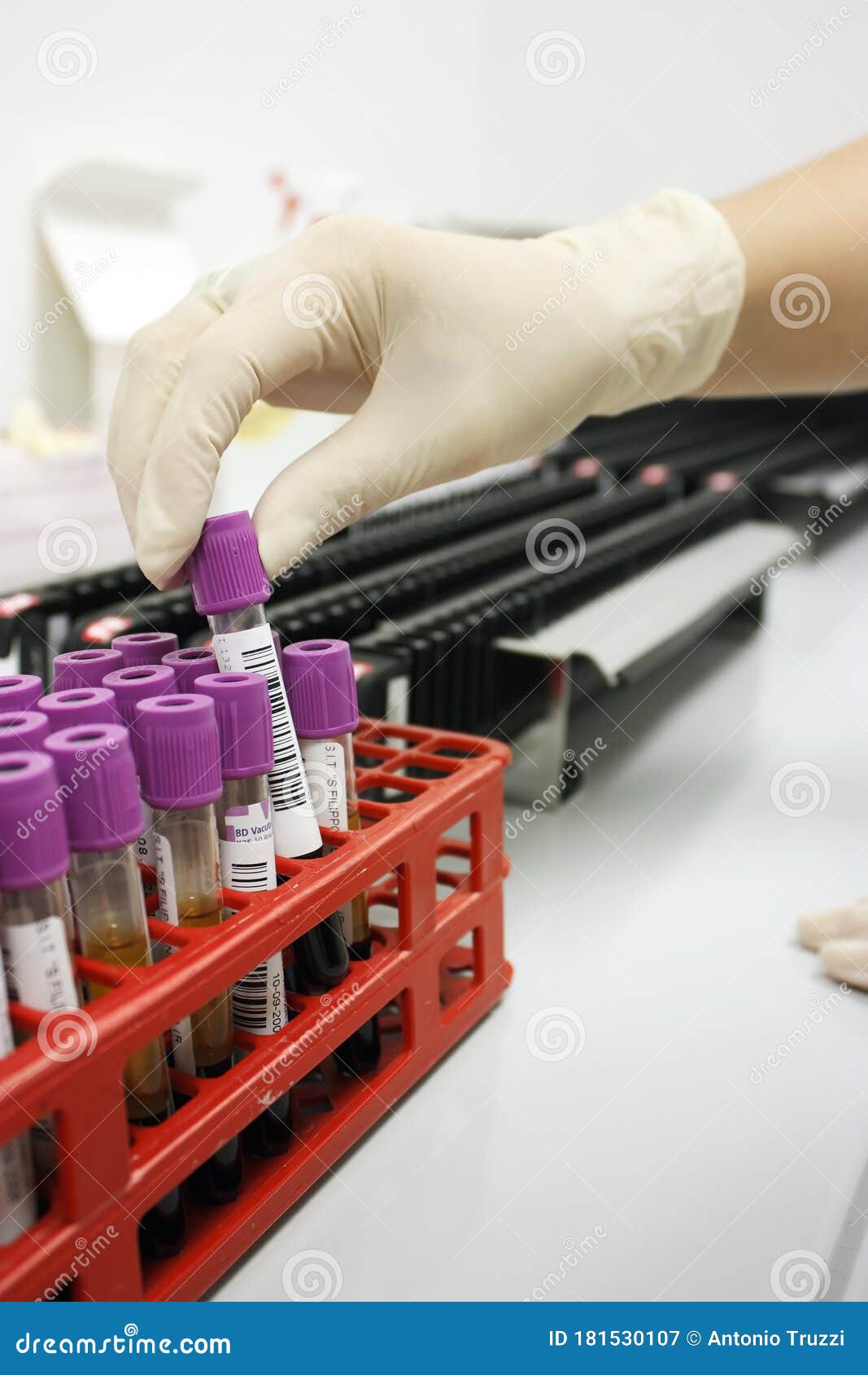 Rack with Test Tubes of Blood Editorial Photography - Image of ...